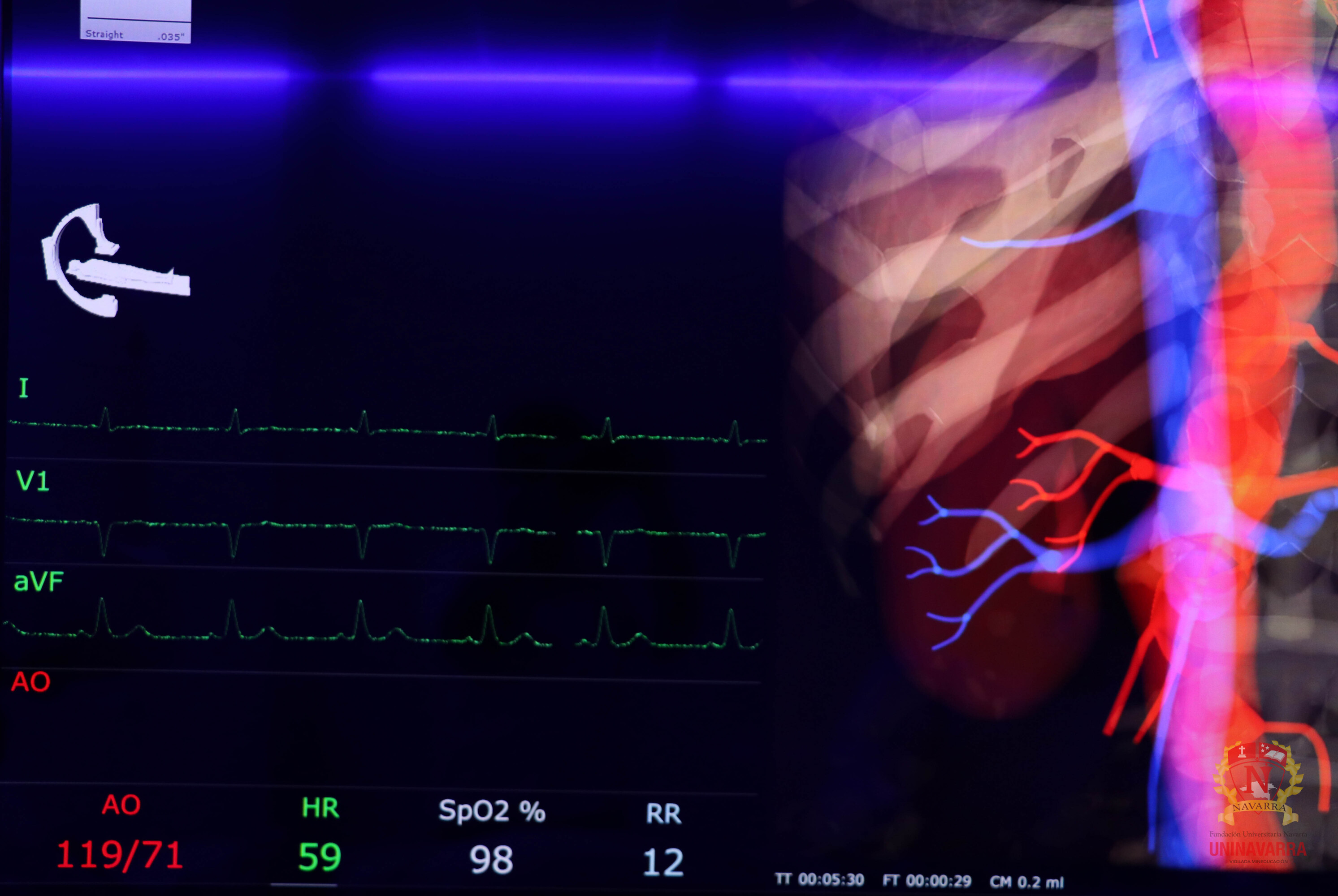 HUSAC – WCMS x CIII